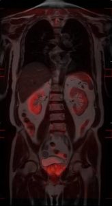 DWIBS ドゥイブス（胸腹部MRIがんドック）／肺ドック - medock 総合健診クリニック