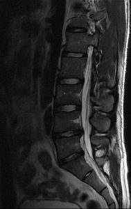 腰痛ドック - medock 総合健診クリニック