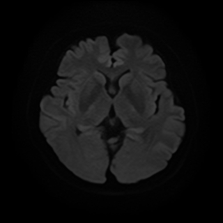 無症状の脳疾患 - medock 総合健診クリニック