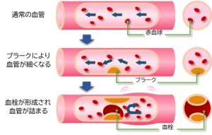 心臓の検査 - medock 総合健診クリニック