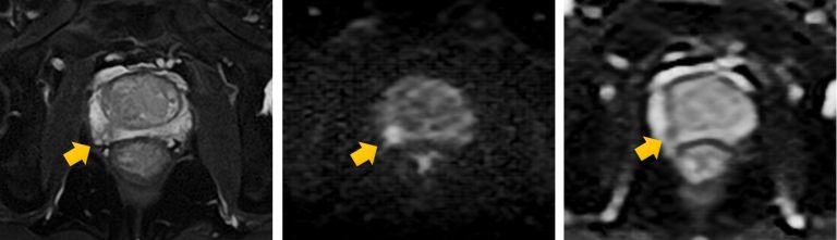 前立腺の検査 - medock 総合健診クリニック